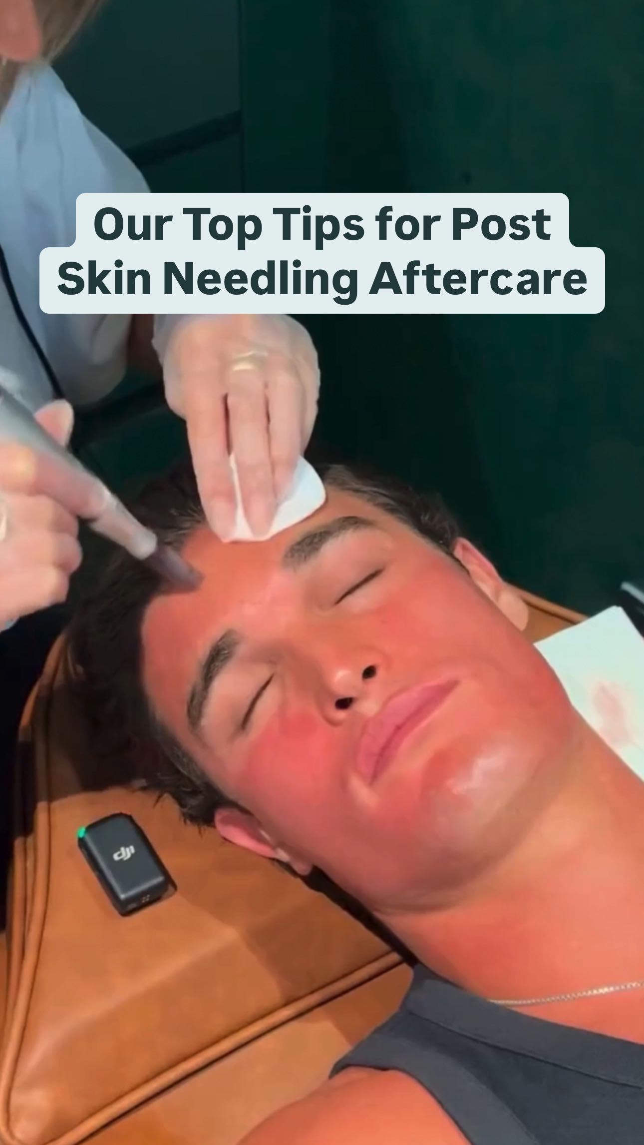 The Skin Bar - Australia's Skin Needling Experts